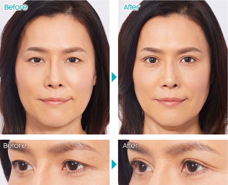 ORISHIKI | DOUBLE EYELID | PRODUCTS | D-UP Corporation