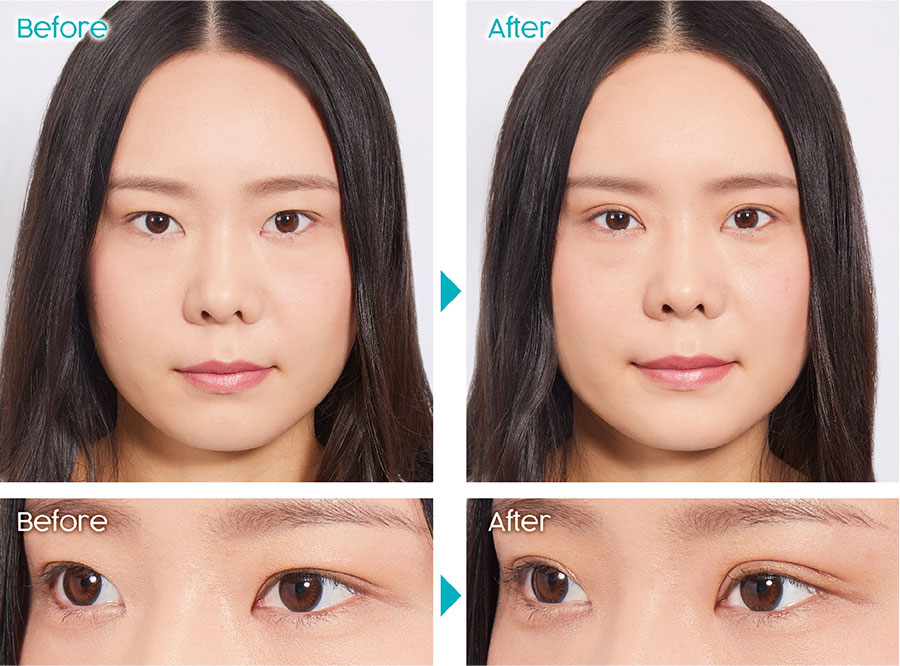 ORISHIKI | DOUBLE EYELID | PRODUCTS | D-UP Corporation